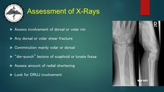 Distal radius fractures | PPTX
