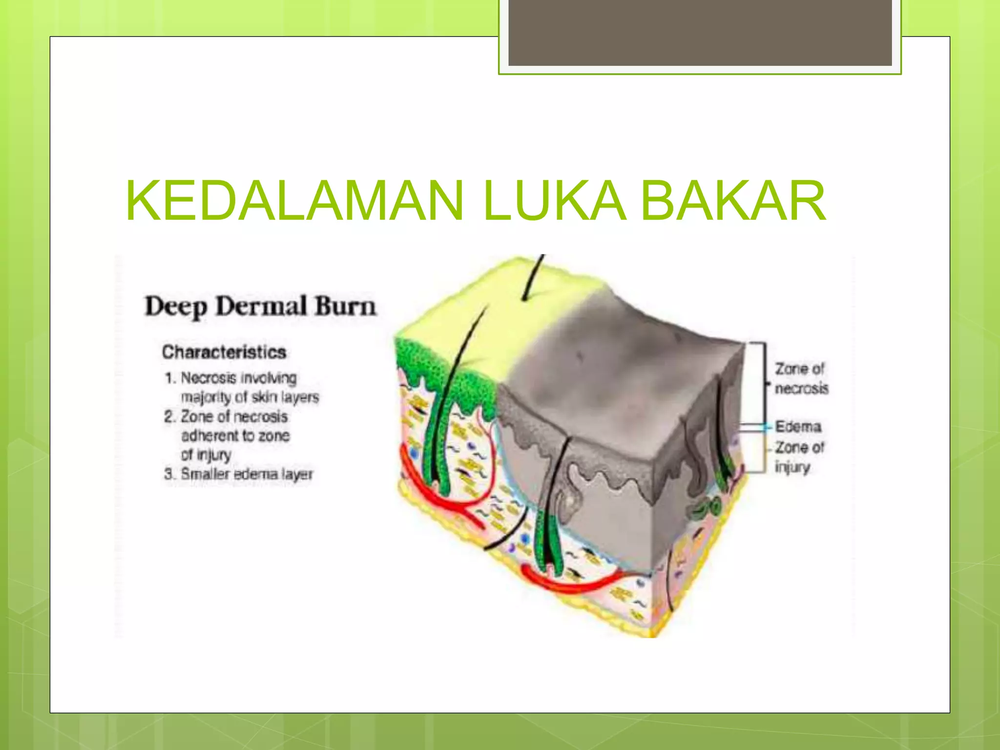 Derajat luka bakar | PPTX