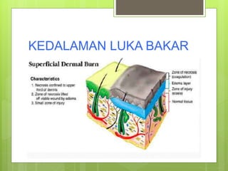 Derajat luka bakar | PPTX