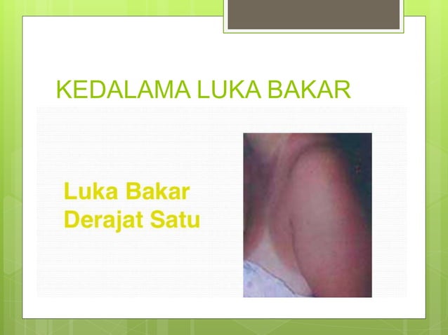 Derajat luka bakar | PPTX
