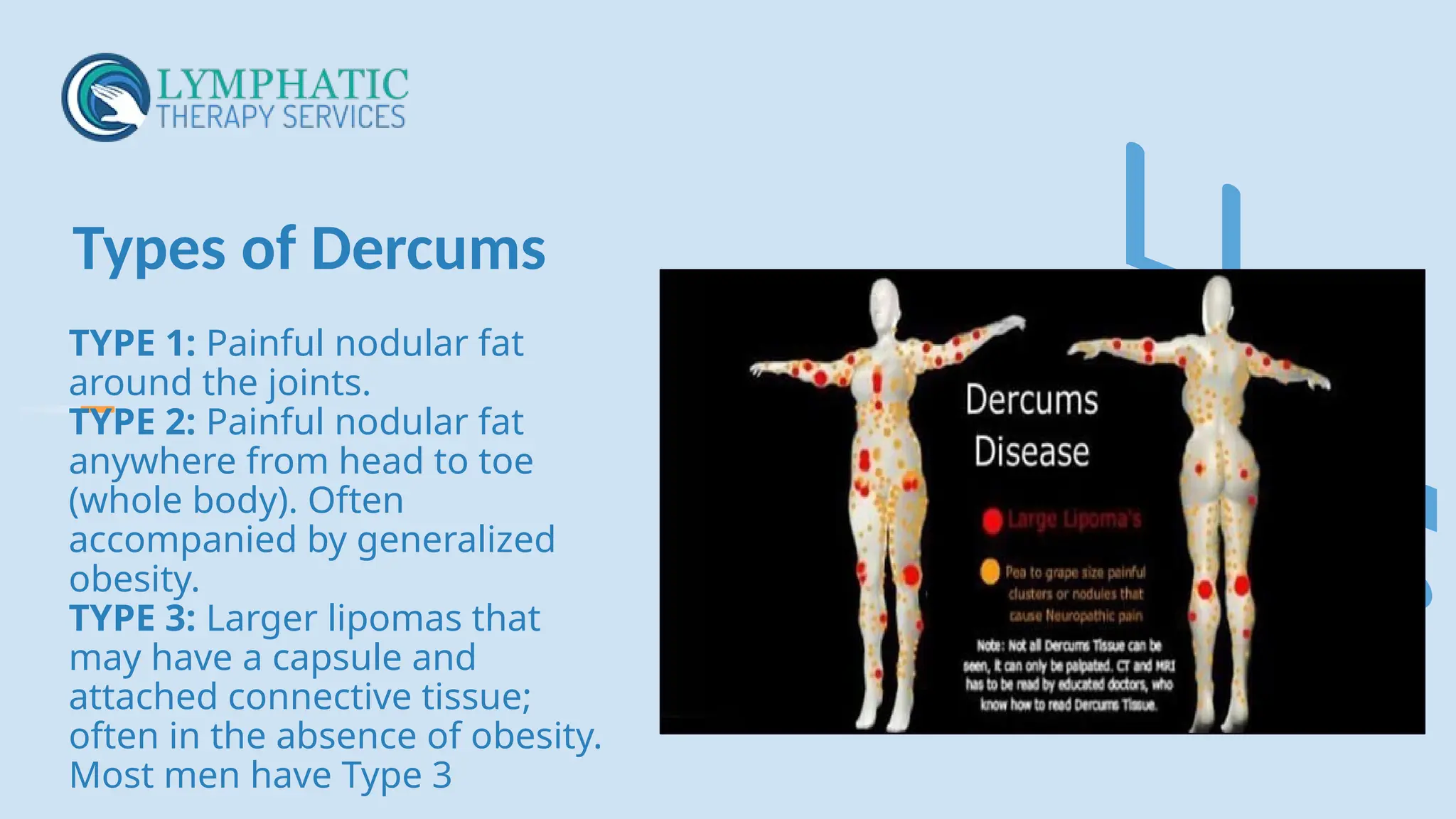 Dercums Disease Treatment San Diego.pptx