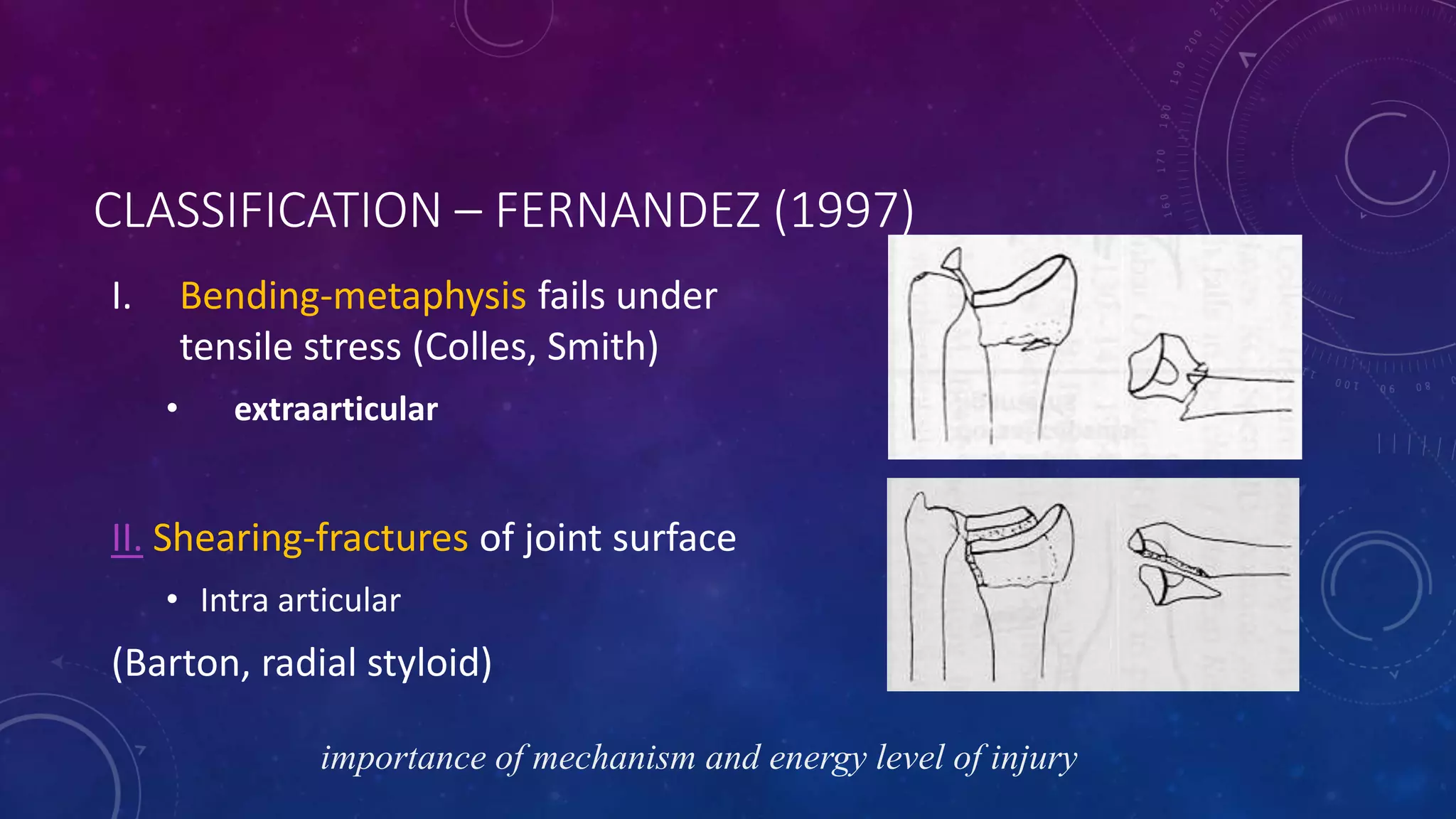distal end radius fracture | PPTX