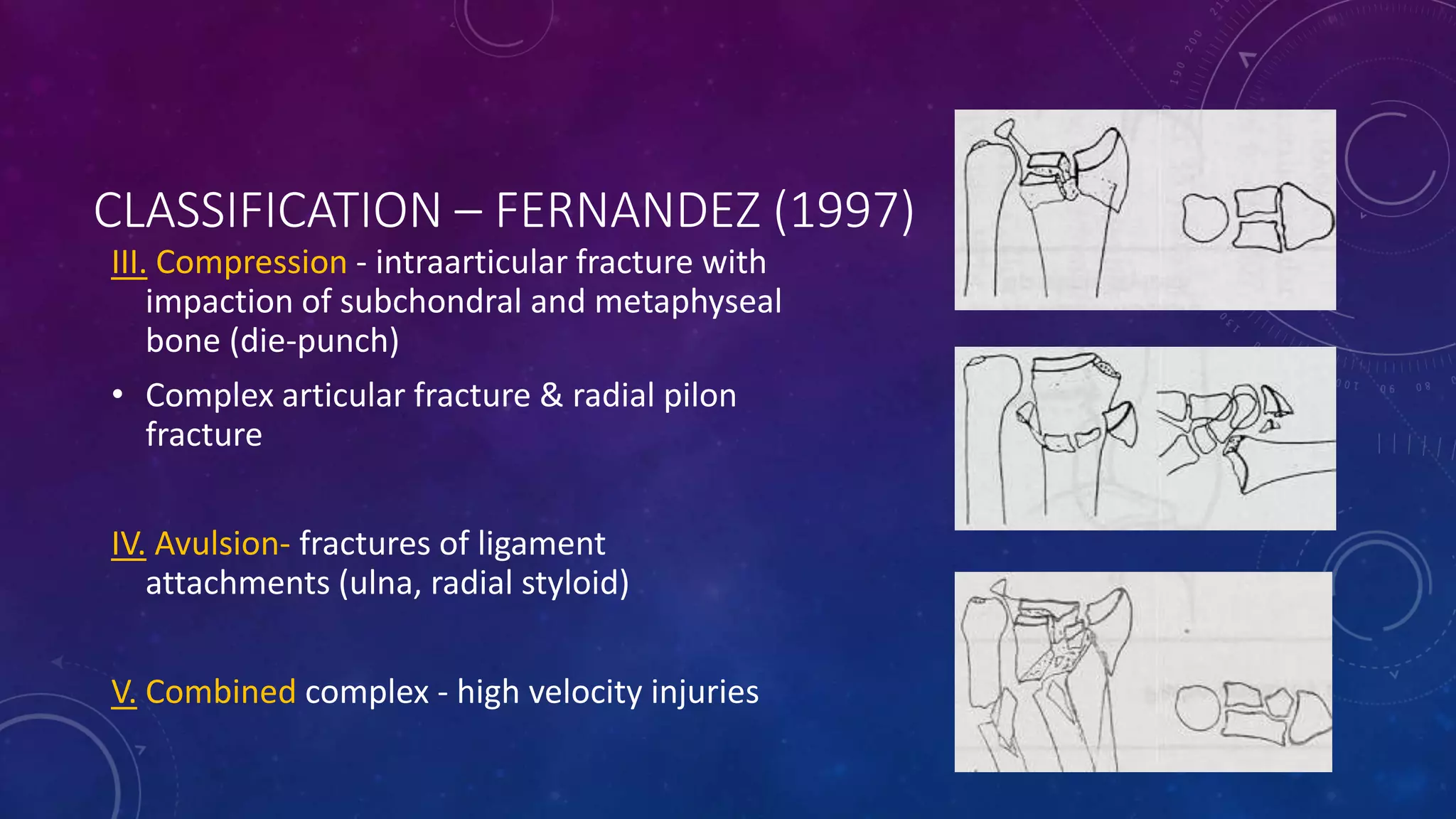 distal end radius fracture | PPTX