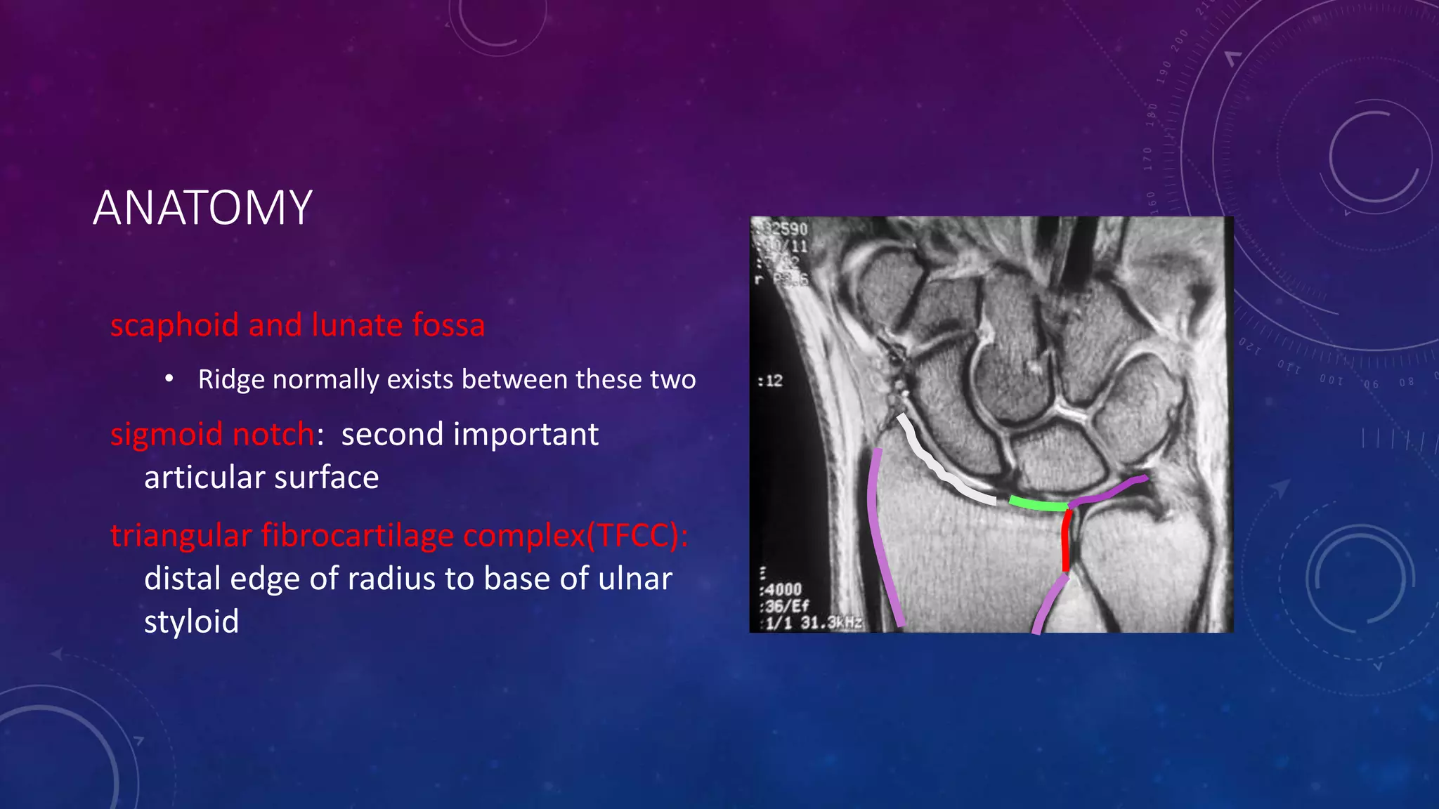 distal end radius fracture | PPTX