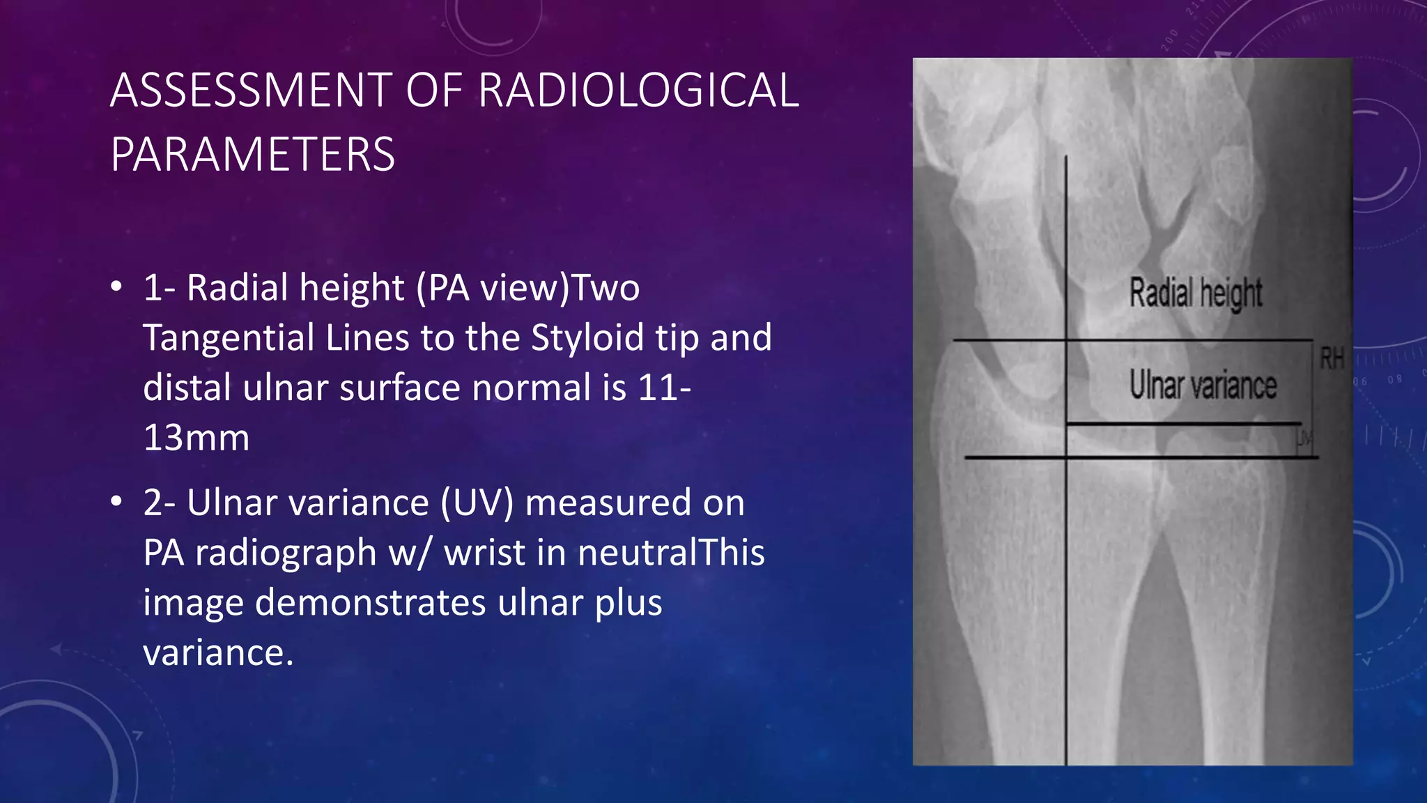 distal end radius fracture | PPTX