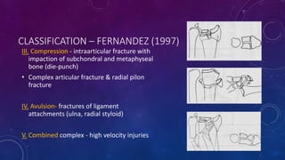 distal end radius fracture | PPTX
