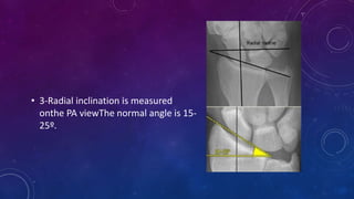 distal end radius fracture | PPTX