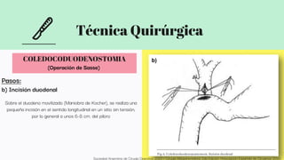 Derivaciones Biliodigestivas.pdf