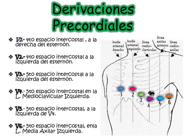 Derivaciones electrocardiograficas.