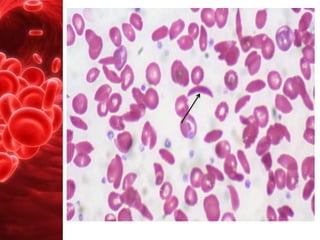 Major forms of hemoglobin and its derivatives/hemoglobinopathies | PPSX