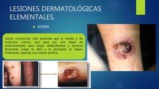 Dermatologia Lesiones elementales | PPTX