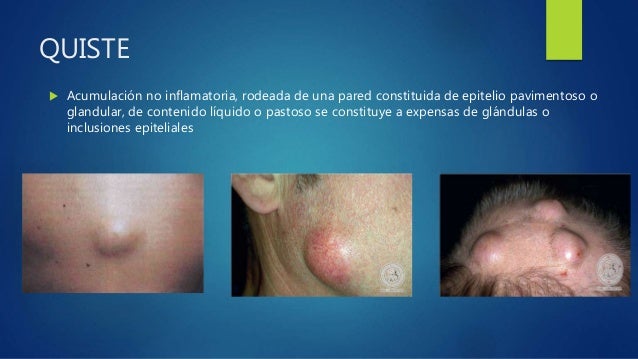 Dermatologia Lesiones elementales