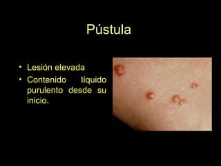 Inspeccion de Piel | PPT