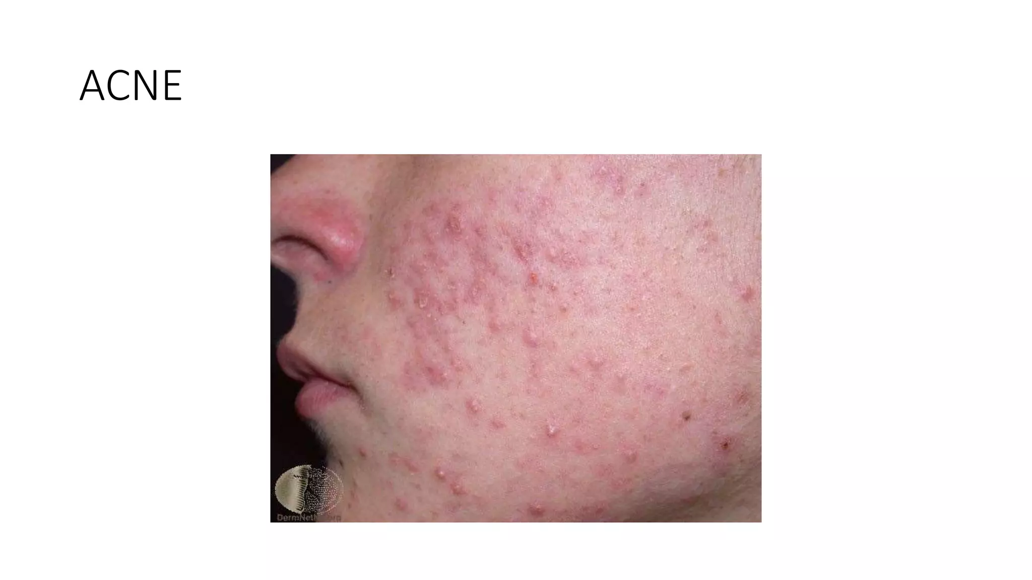 Derma by Dr danish.pptx