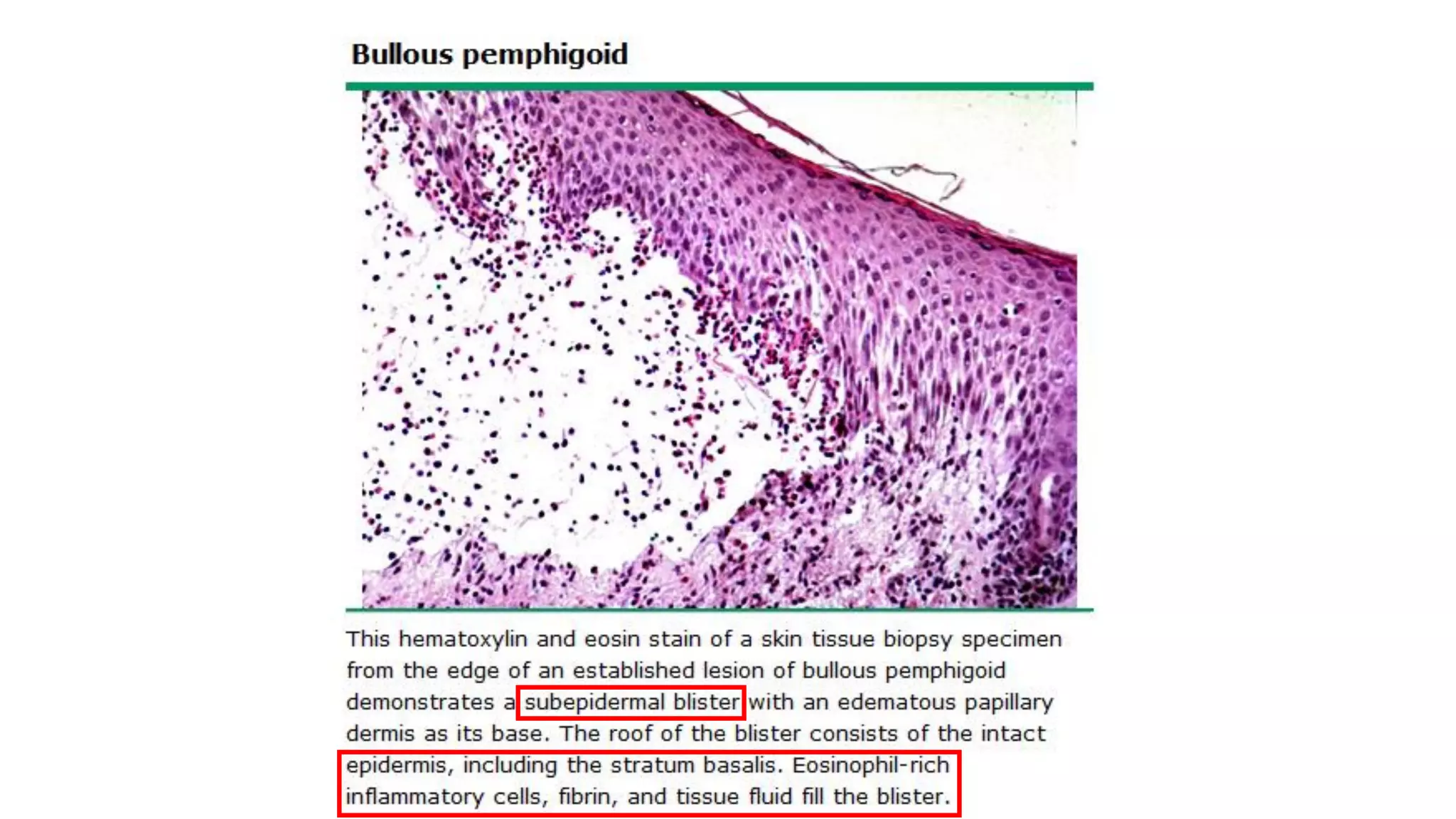 Dermatology case presentation | PDF