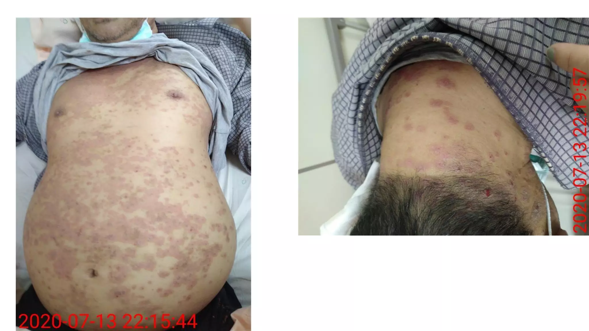 Dermatology case presentation | PDF