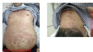 Dermatology case presentation | PDF