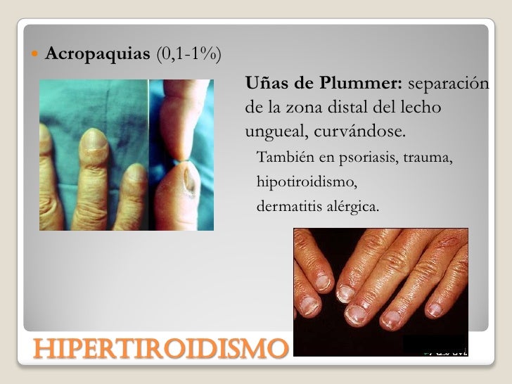 Dermatología en endocrino