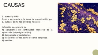 derma expo impetigo, oliculitis, celulitis, etc. | PDF
