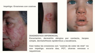 derma expo impetigo, oliculitis, celulitis, etc. | PDF