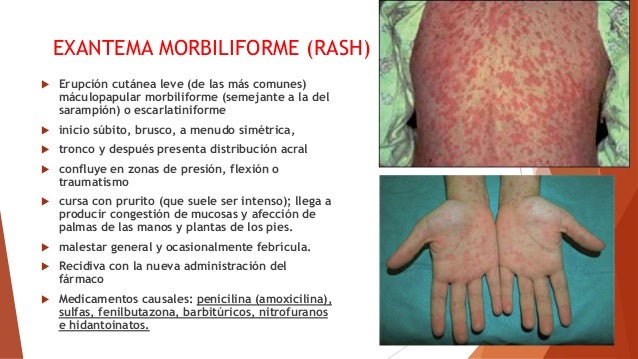 DERMATOLOGIA_FARMACODERMIAS