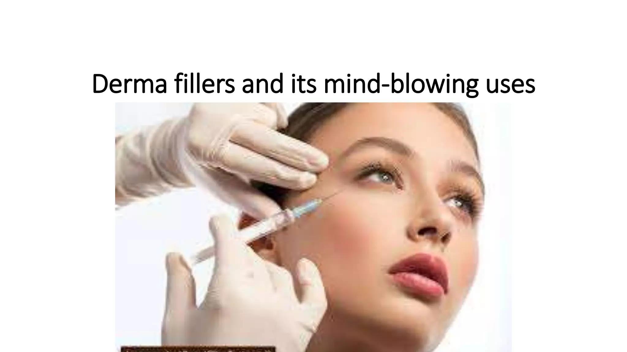 Derma fillers and its mind blowing uses | PPTX