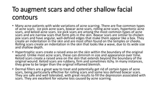 Derma fillers and its mind blowing uses | PPTX | Skin and Dermatology ...