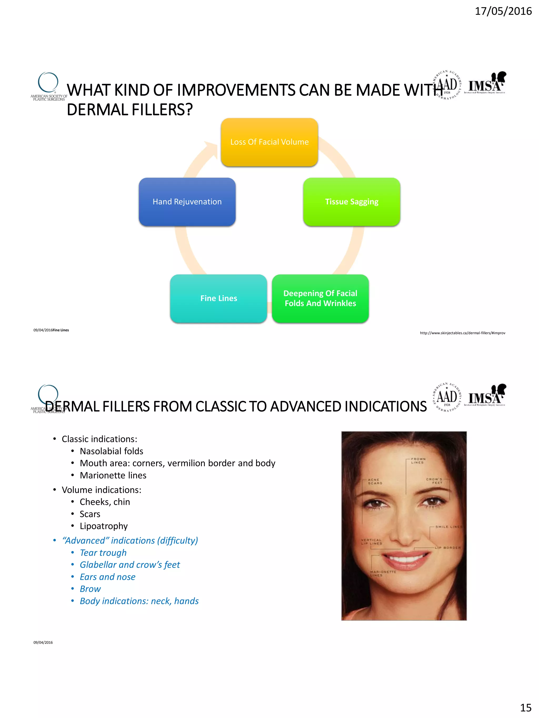 Dermal filler from basic to practice | PDF