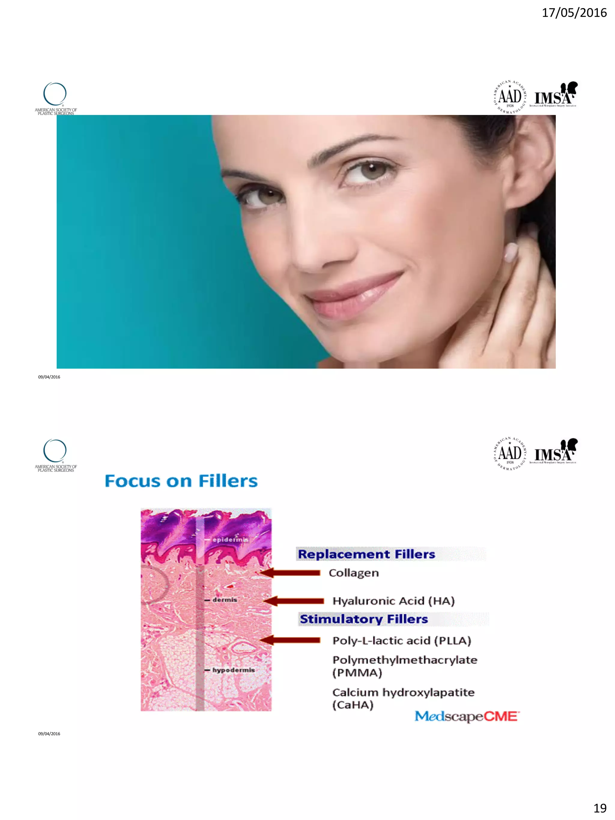 Dermal filler from basic to practice | PDF