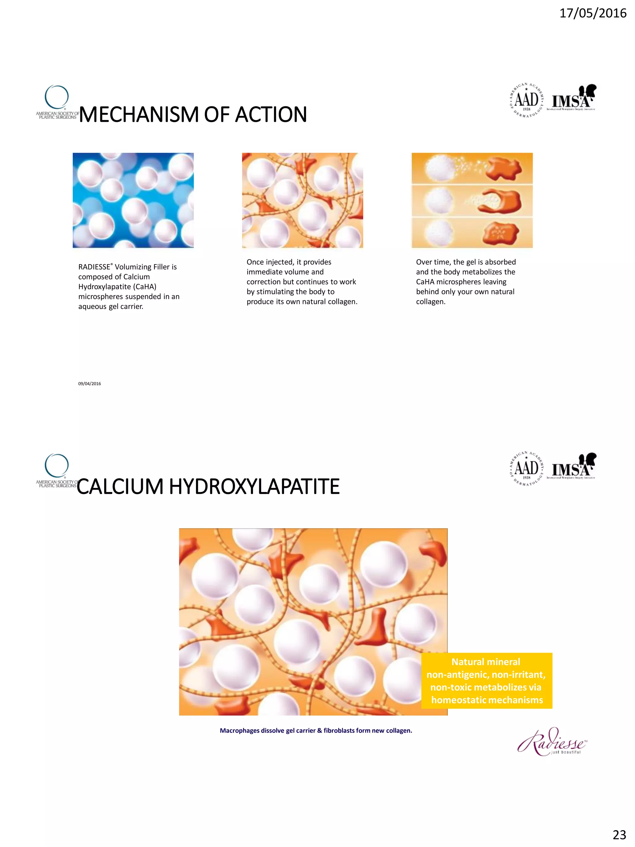 Dermal filler from basic to practice | PDF