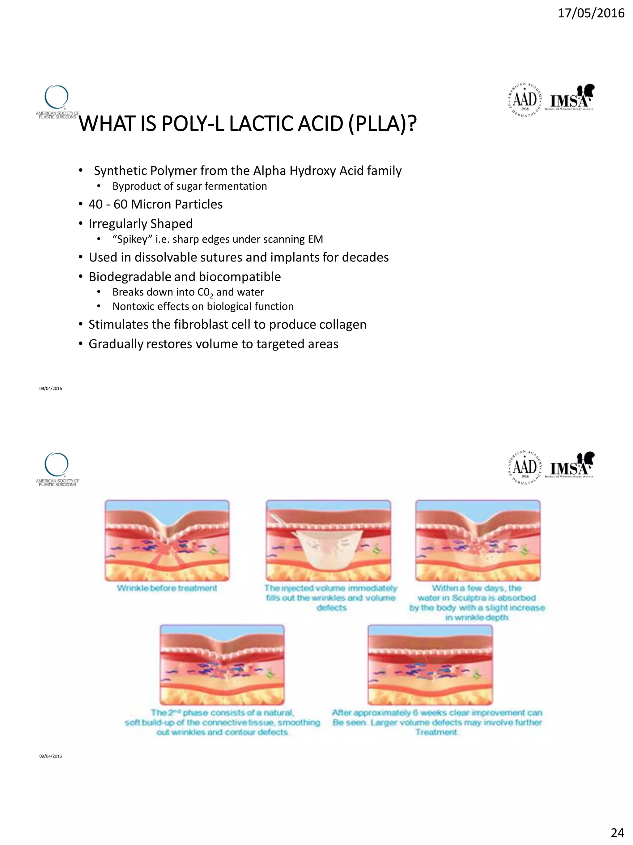 Dermal filler from basic to practice | PDF