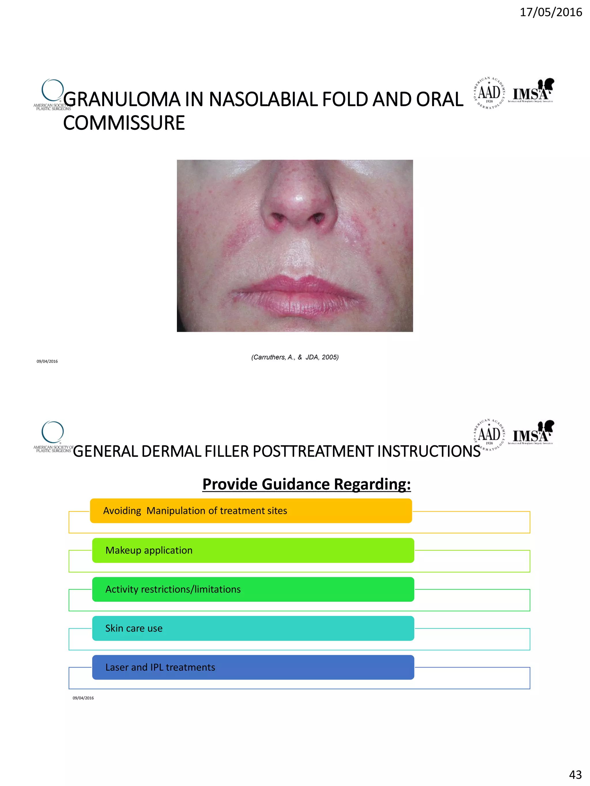 Dermal filler from basic to practice | PDF
