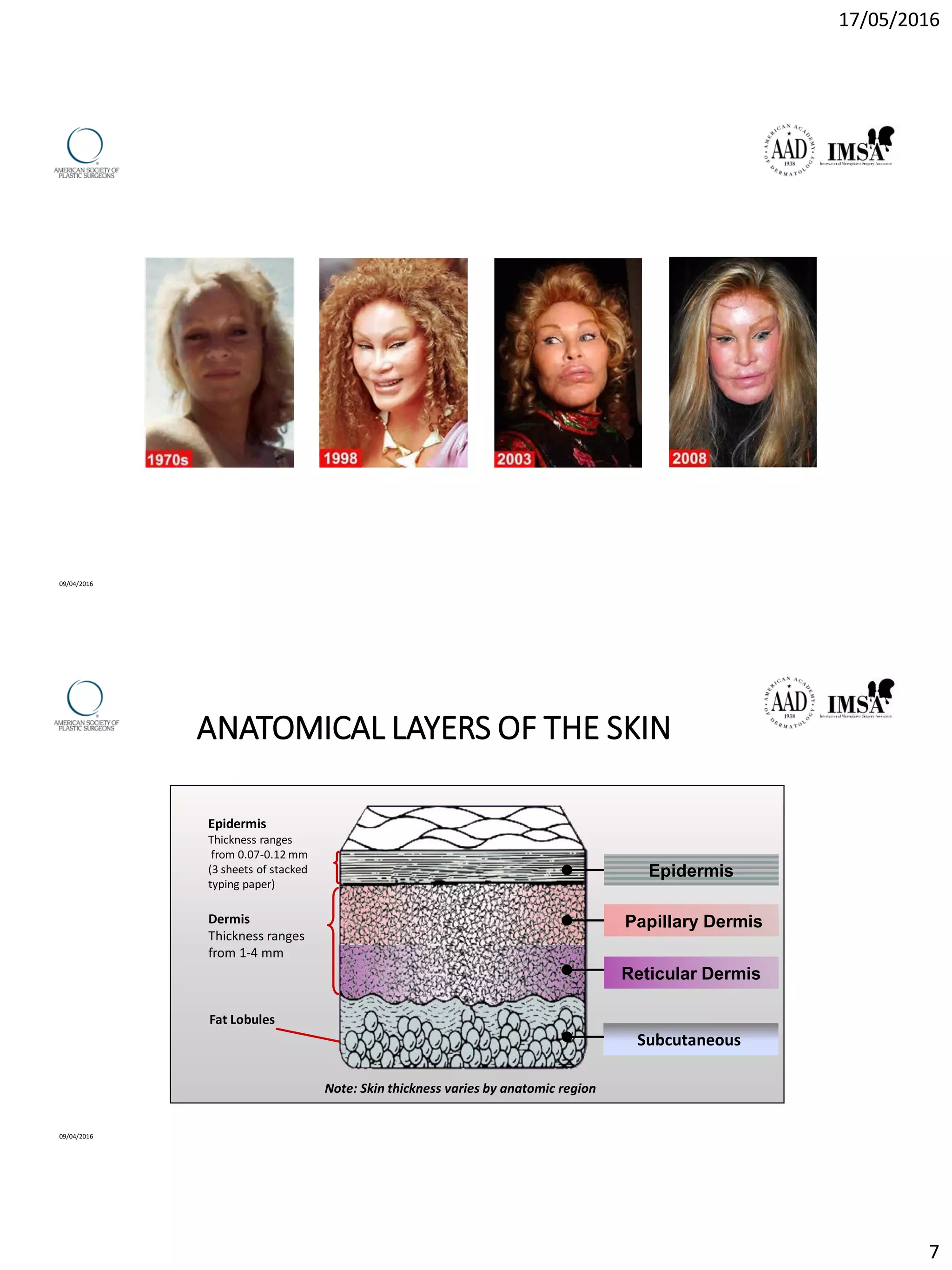 Dermal filler from basic to practice | PDF