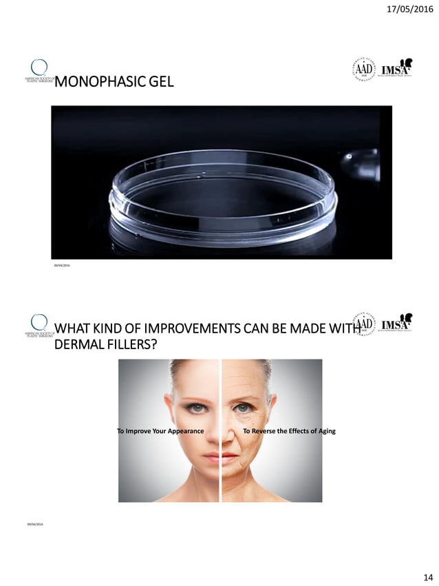 Dermal filler from basic to practice | PDF | Skin and Dermatology ...