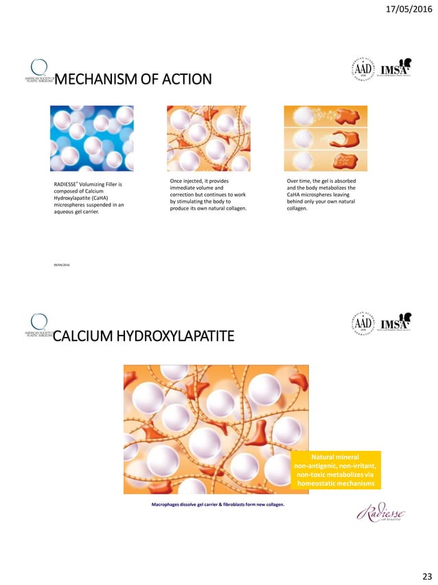 Dermal filler from basic to practice | PDF | Skin and Dermatology ...