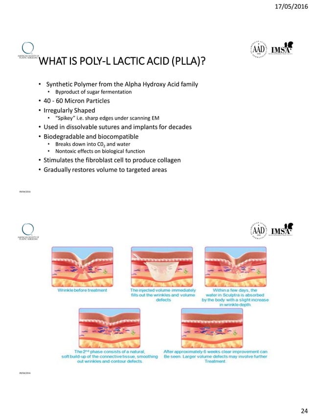 Dermal filler from basic to practice | PDF | Skin and Dermatology ...