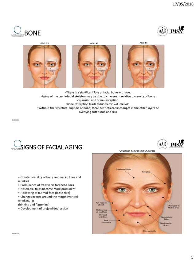 Dermal filler from basic to practice | PDF | Skin and Dermatology ...