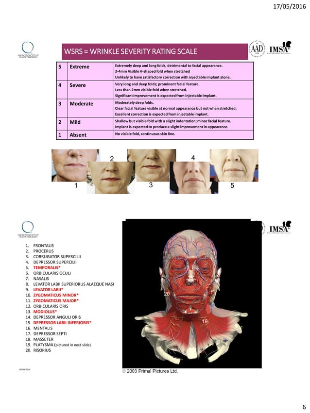 Dermal filler from basic to practice | PDF | Skin and Dermatology ...