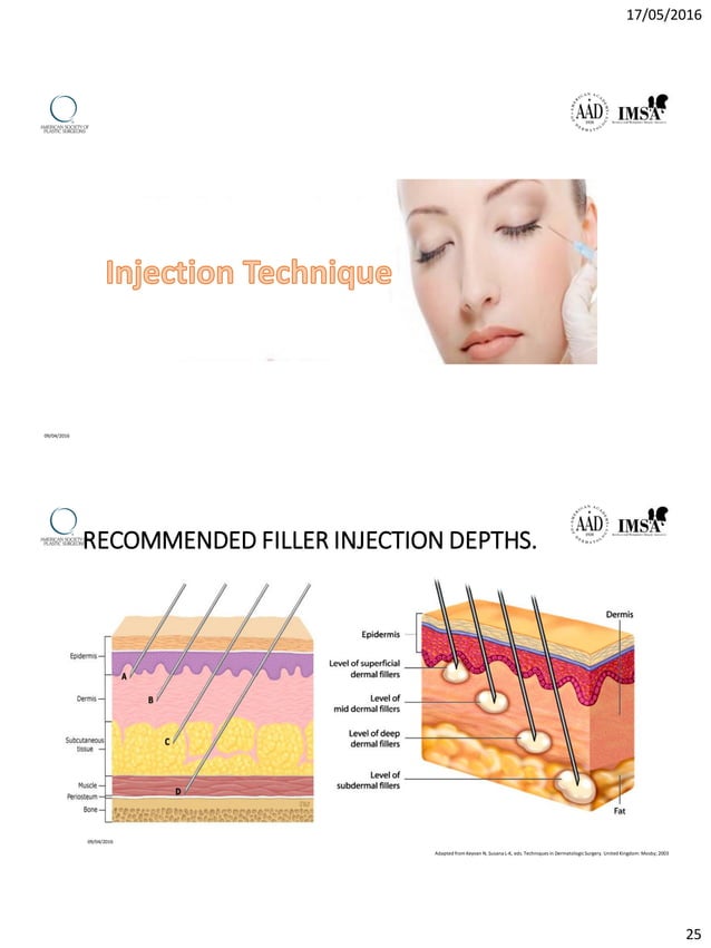 Dermal filler from basic to practice