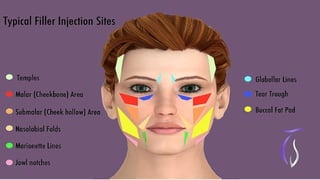 DERMAL FILLERS including anatomy, injection points , complications and ...