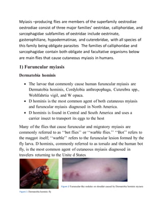 Cutaneous Myiasis