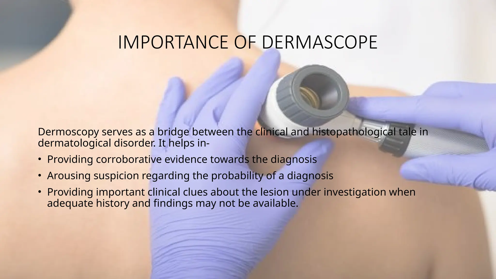Dermoscopy in Dermatology: Principles, Patterns, and Clinical ...