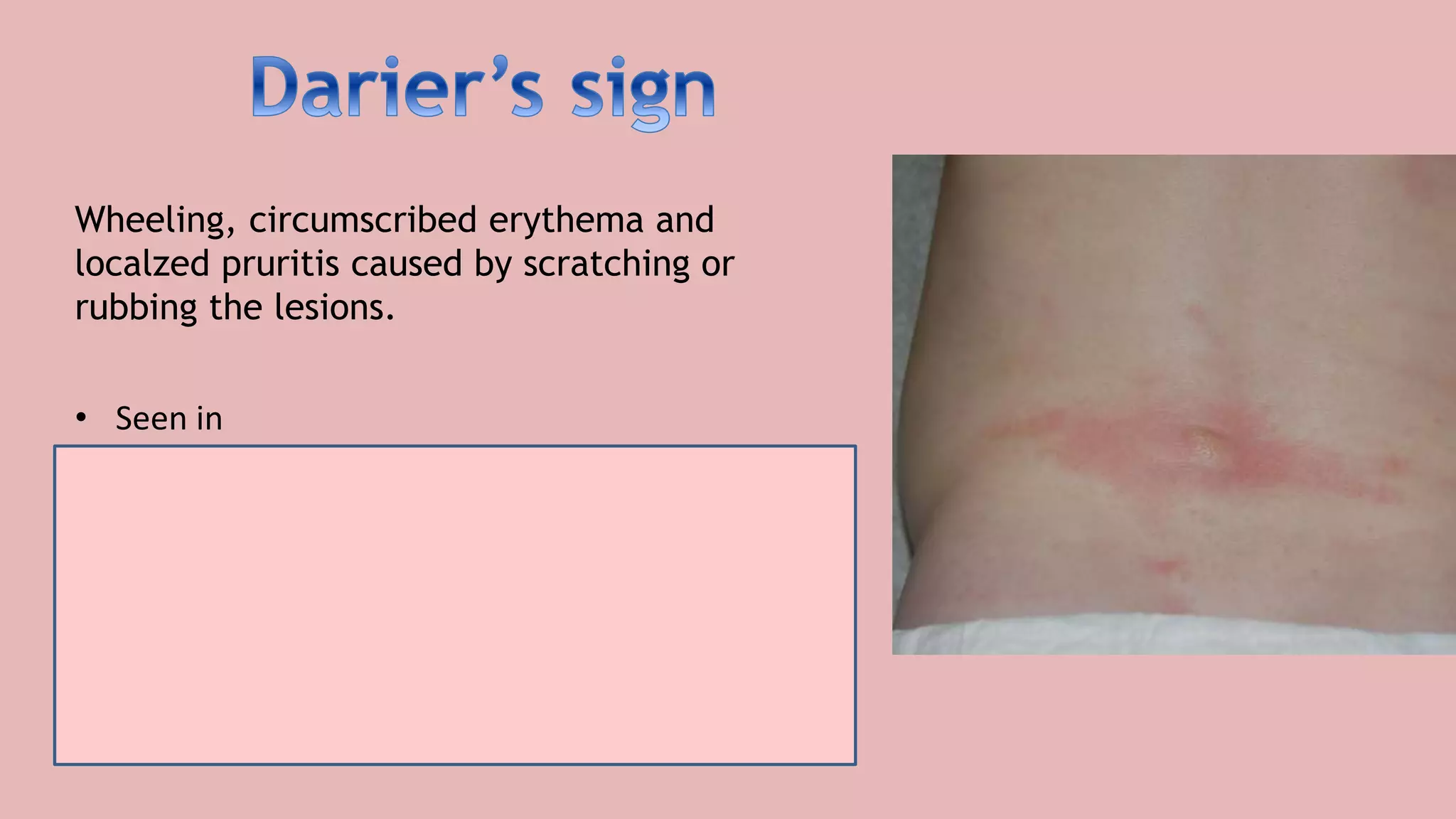 Derma signs | PPTX