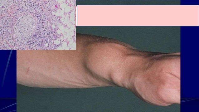 Derma signs | PPTX | Skin and Dermatology | Diseases and Conditions