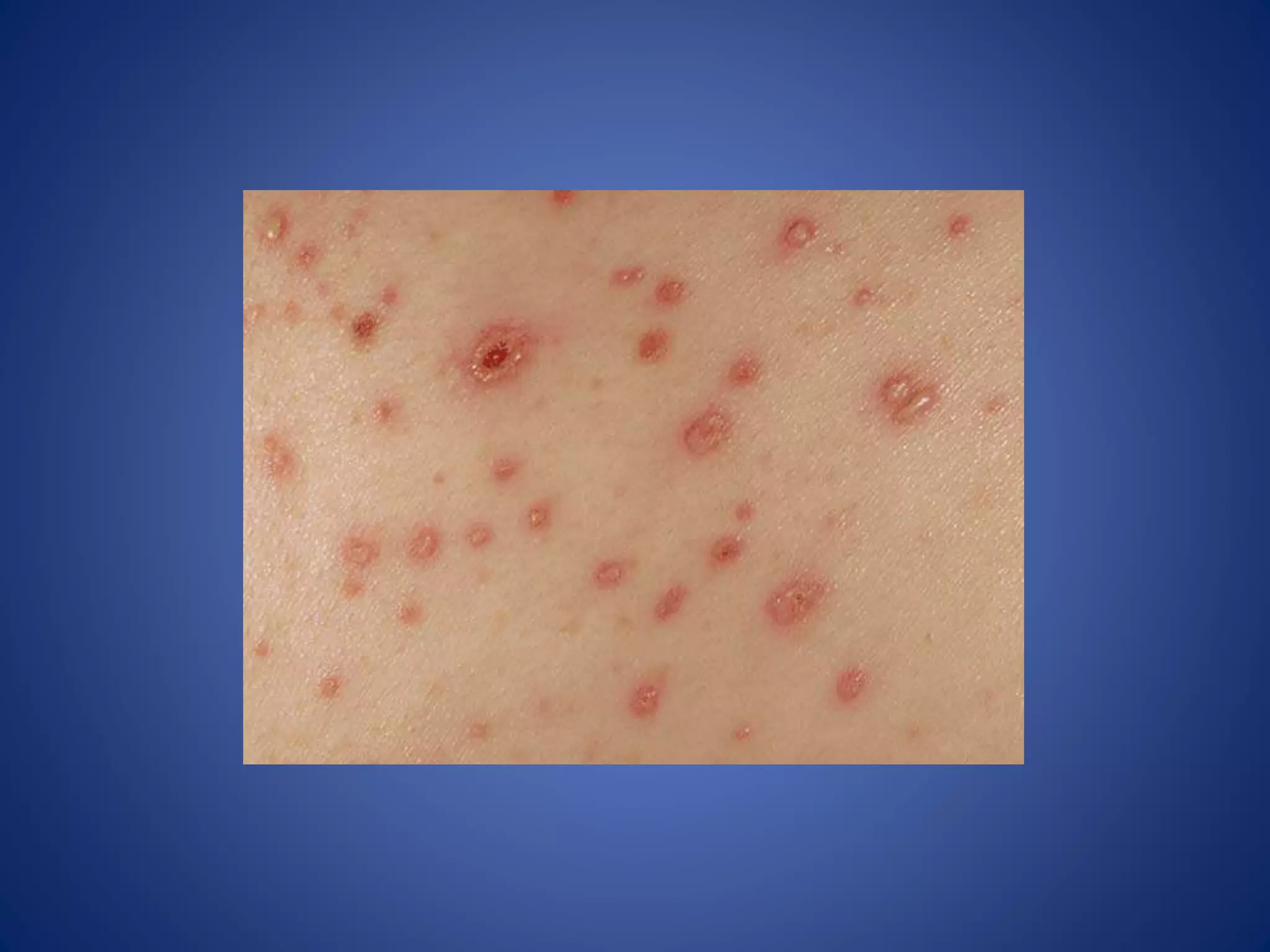 Dermatology made easy | PPTX
