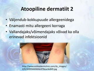 Dermatiit | PPTX