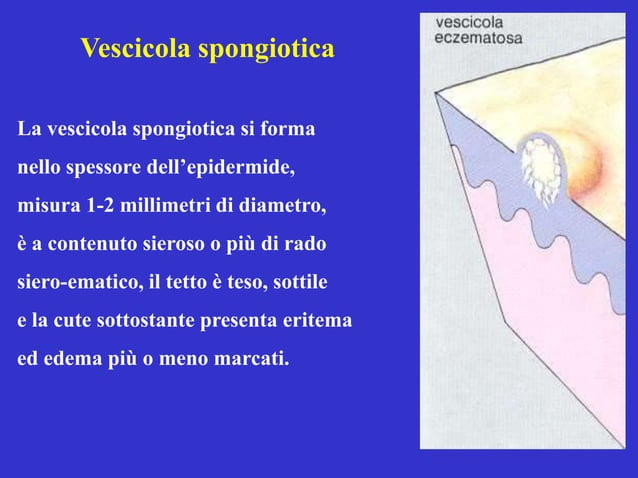 Dermatiteatopica 111110052757-phpapp02 | PPTX | Skin and Dermatology ...