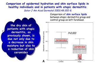 Atopic dermatitis exacerbations | PPT