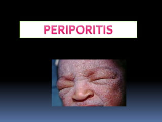 Dermatitis | PPTX