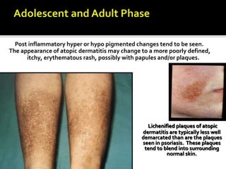 Dermatitis | PPTX